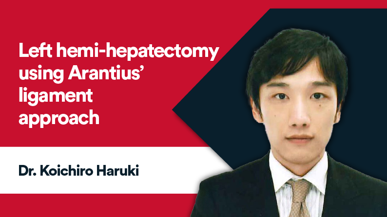 Video List | Ethicon